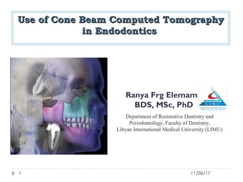 Use Of Cone Beam Computed Tomography In Endodontics Ppt