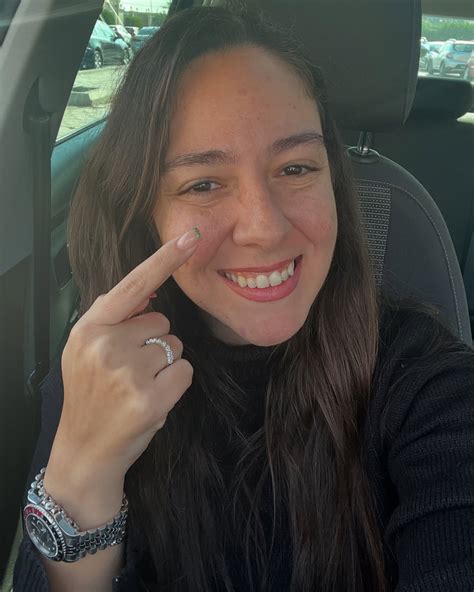 مش معقولة يوم واحد اقعد في الشمس النمش يظهر و ينور كده يا جماعة 🙈🙄😂 قبل متقولو اي حاجة أنا مبحبش