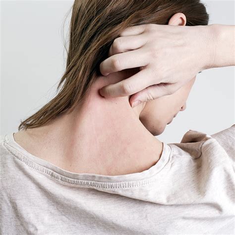 How To Treat Dry Skin During The Winter Rochester Regional Health