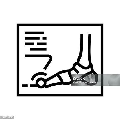 발 Gout Diesase 라인 아이콘 벡터 일러스트의 엑스레이 방사선 사진 건강관리와 의술에 대한 스톡 벡터 아트 및 기타