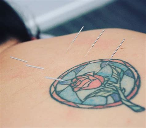 Our Story Traditional Acupuncture Clinic Ashmore