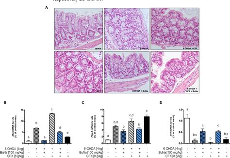 Figure 4 From Dual Hit Model Of Parkinsons Disease Impact Of