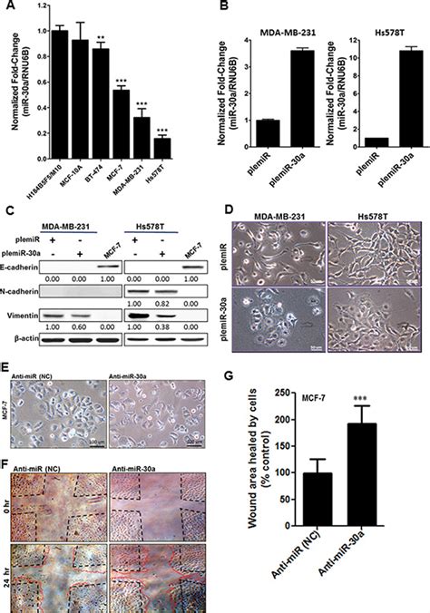 Microrna 30a Increases Tight Junction Protein Expression To Suppress