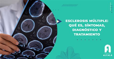 Esclerosis Múltiple Formación Alcalá