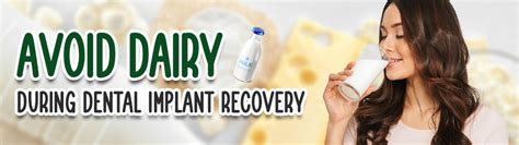 Milk Dental Implant Recovery The Oaks Dental Center