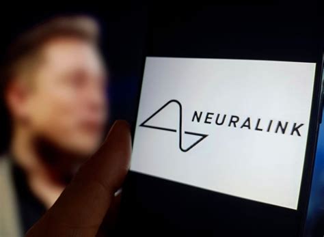 Neuralink Sabe Há Anos Que Fios Do Seu Dispositivo Cerebral Podem Se Soltar Mostra Reportagem