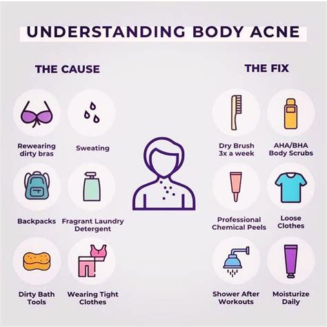 Back Acne Main Causes At Erica Jane Blog