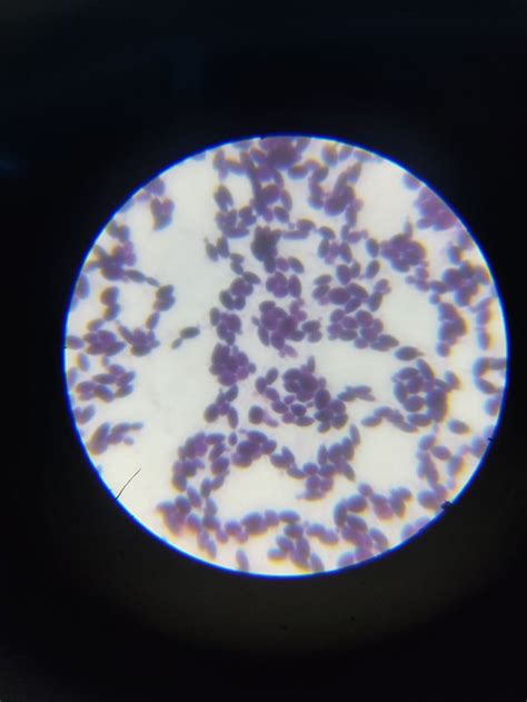 Scale Bar Reference Using Imagej Rmicrobiology