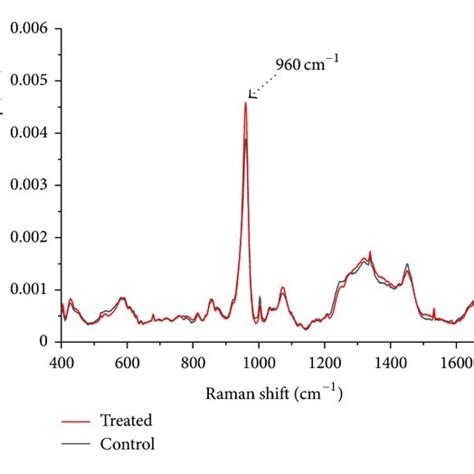Mean Normalized Raman Spectra Of The Bones From Control Group And Download Scientific Diagram