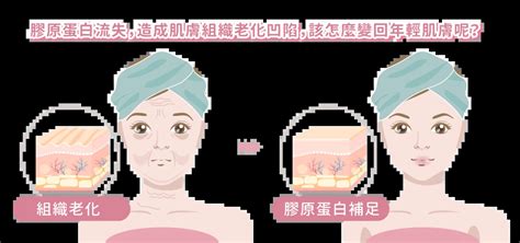 25歲以後膠原蛋白流失該怎麼辦？