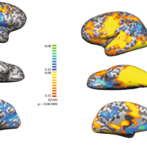 A Ffx Glm Group Activation Map For The Inner Speech Runs Q Fdr