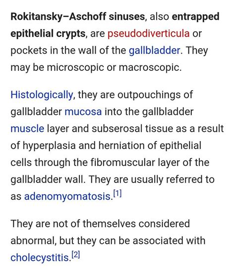 Note Rokitansky Nodule Is Find In Mature Cystic Teratoma Cystic Teratoma Sinusitis