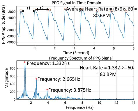 Precision Heart Rate Estimation Using A Ppg Sensor Patch Equipped With