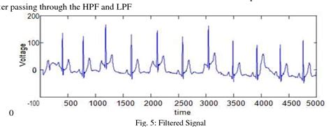Figure 5 From Vlsi Implementation Of The Dwt Based Arrhythmia Detection Architecture Using Co