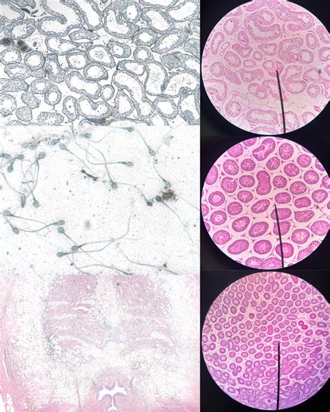 Male Reproductive System Histology Diagram Quizlet