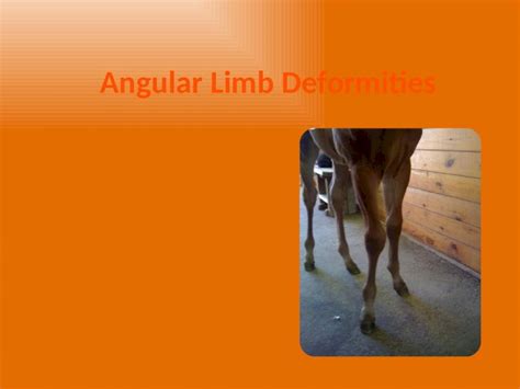 Pptx Angular Limb Deformity Dokumentips