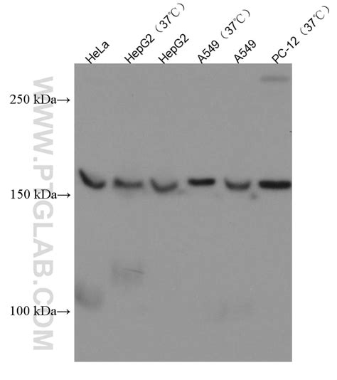 Bsep Fusion Protein Ag29121 Proteintech
