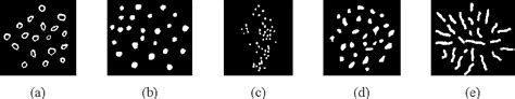 Figure 1 From Development Of A Cad System For Automatic Classification