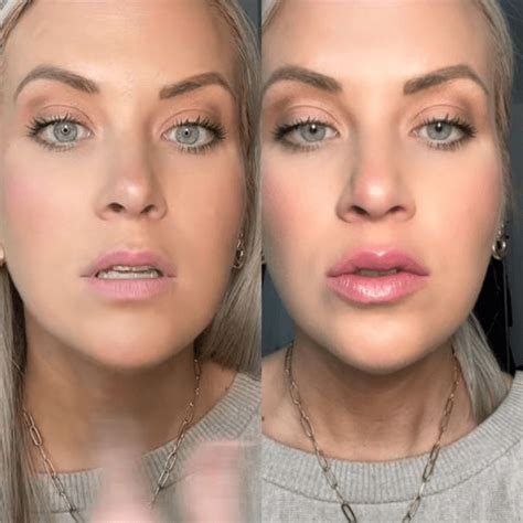 Volumising Lip Duo Instant Lip Plumper Plump It