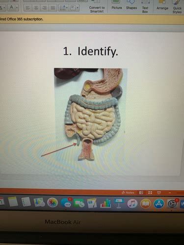 Lab Quiz 11 Flashcards Quizlet