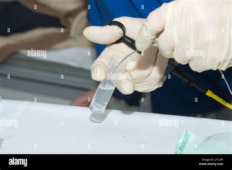 An Endoscopic Probe Being Sterilized Before Insertion Into A Patient