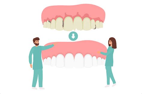 치과 진료소 및 의료 개념 여자와 남자 치과 의사 만화 캐릭터는 함께 거대한 인간의 치아의 상태를 검사하고 벡터 일러스트 레이