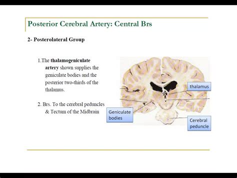 Posterior Circulation Stroke Syndromes Ppt