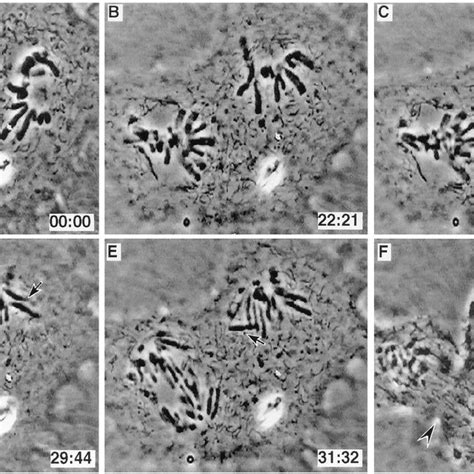 A F Selected Video Images From An Untreated Ptk1 Cell With