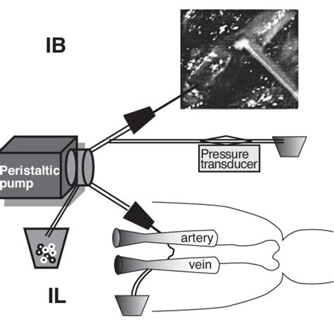 Comparison Of Intravenous I V And Isolated Limb Perfusion Il A
