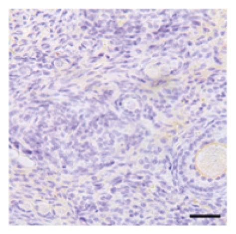 Ucmsc Location Using Ihc Staining ×400 A Control Group B Poi
