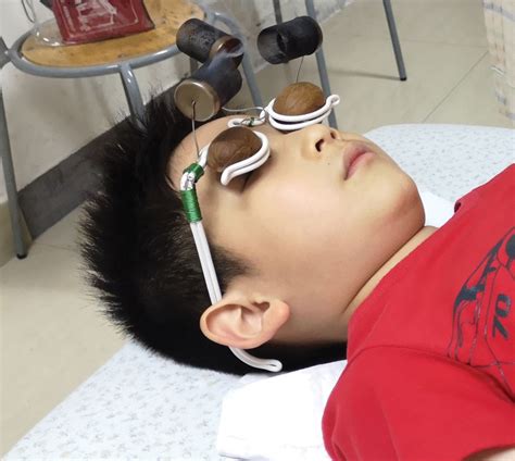 Treating Adolescent Pseudomyopia And Elevated Intraocular Pressure