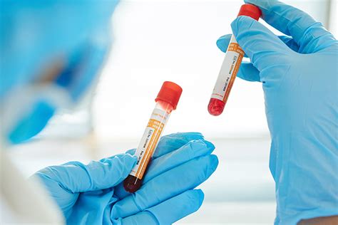 Perfil Bioquímico De 24 Elementos Smac Haema