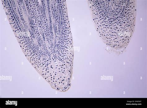 Mitosis Under Microscope Labeled