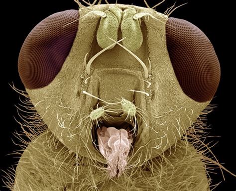 Images Under Electron Microscope