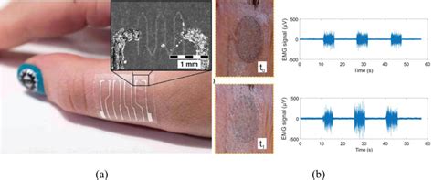 A Inkjet‐printed Graphenepedotpss Temperature Sensor On Skin Download Scientific Diagram