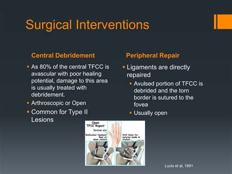 The Distal Radioulnar Joint And Tfcc Pptx