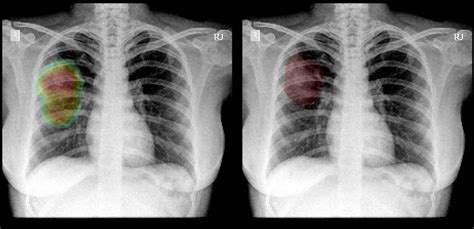 Gradient Based Algorithms For Deep Learning Classification