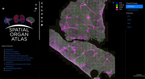Human Liver Nanostring