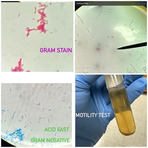 Solved Which Of These Bacteria Is This Micrococcus