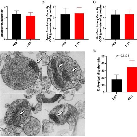 Doxorubicin Treatment Does Not Significantly Alter Mitochondrial