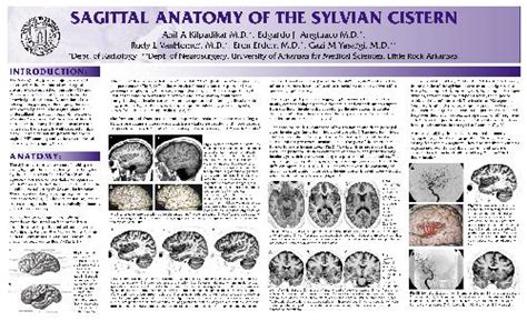 دانلود کتاب Sagittal Anatomy Of The Sylvian Cistern