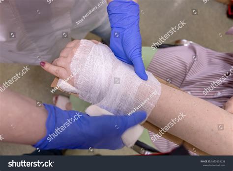 74 Applying Splints Images Stock Photos Vectors Shutterstock