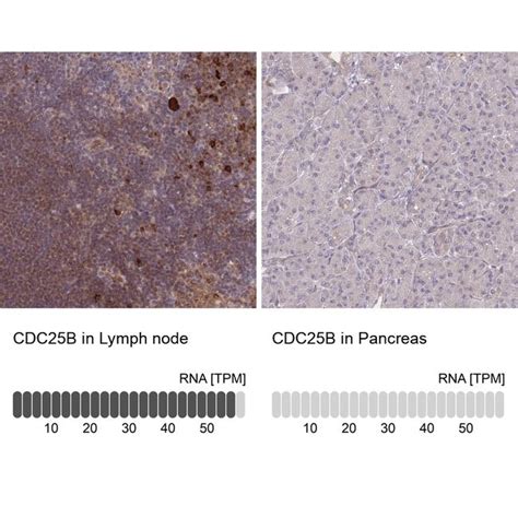 Cdc25b Polyclonal Antibody Invitrogen™ 100 μl Unconjugated Fisher
