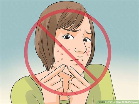 How To Deal With Pimples With Pictures WikiHow Life