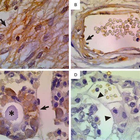 Vimentin Expression In Human Breast Cancer Cells Mda Mb 231 And