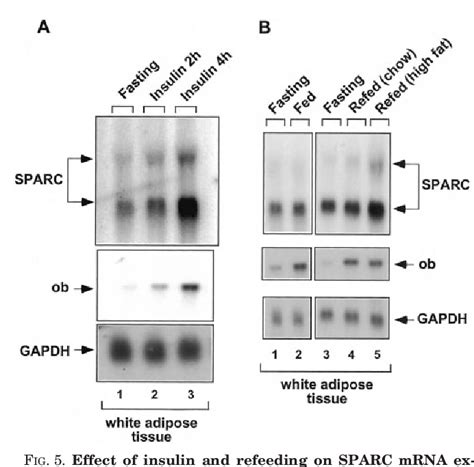 [pdf] The Matricellular Protein Sparc Osteonectin As A Newly Identified Factor Up Regulated In