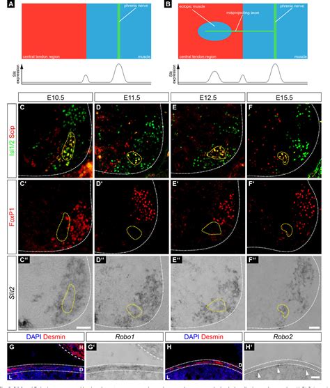 Figure 5 From The Role Of Sema3npn 1 Signaling During Diaphragm