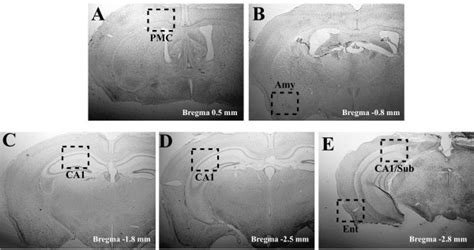 Representative Nissl Stained Brain Sections From 3xtg Ad Mice Depicting Download Scientific