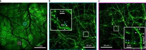 Mesoscope Volumetric Imaging With Synaptic Resolution Scanning A Bessel