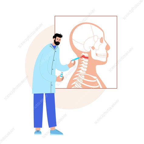 Spinal Injection Illustration Stock Image F036 5579 Science Photo Library